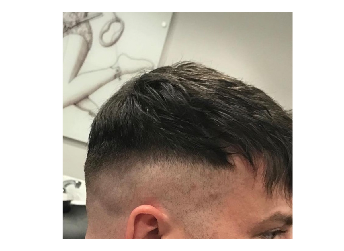 Total Cover Plus Hair System - The Hair Lounge